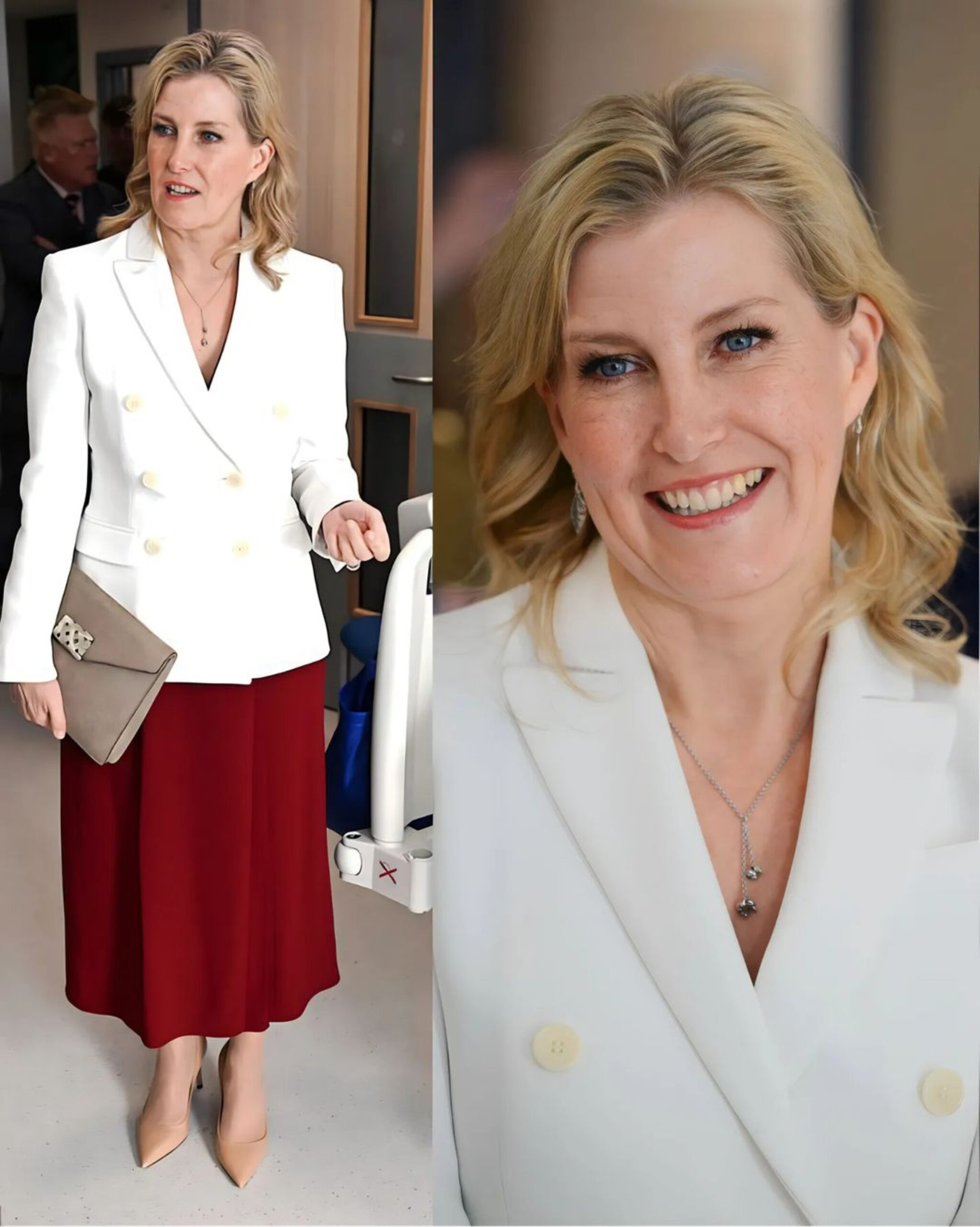 The Duchess of Edinburgh visited the Robert Jones and Agnes Hunt ...